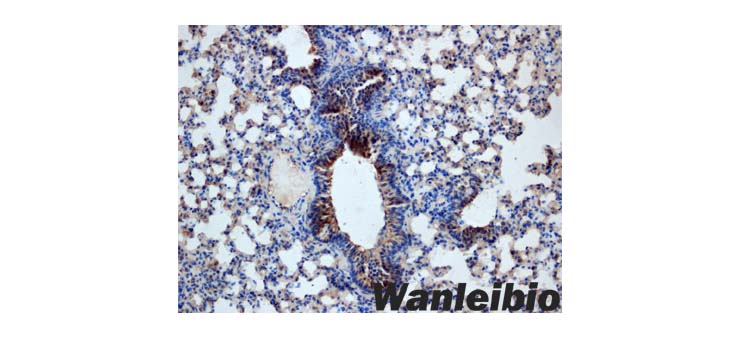 万类生物-试剂商城-HO-1/Heme Oxygenase 1