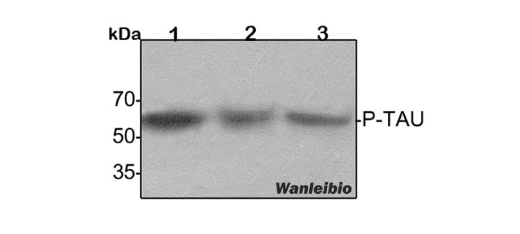万类生物-试剂商城-P-TAU（S396）