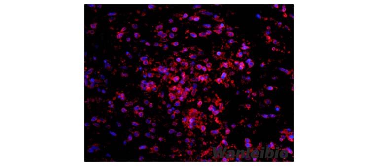 万类生物-试剂商城-P-TAU（S396）