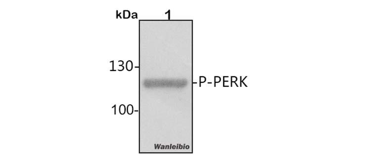 万类生物-试剂商城-P-PERK（T982）